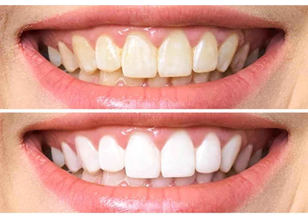 Cosmetic - Trudental